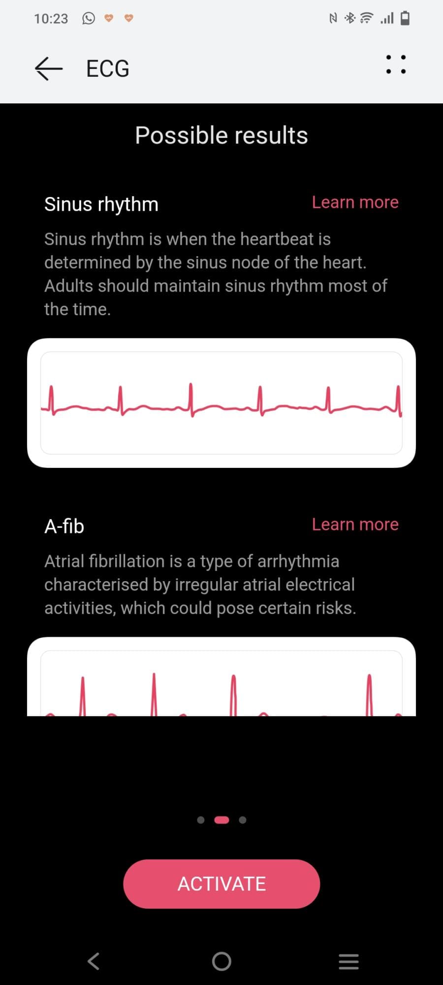 Huawei a obținut certificarea CE pentru aplicația sa de EKG. Cum ...